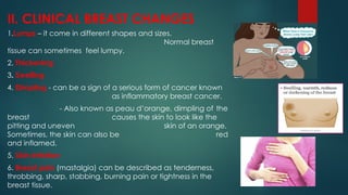 Carcinoma is a term used to describe a cancer that starts in the lining ...