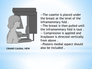 Role of mammography and MRI in Breast disorders | PPTX