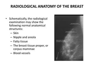 Breast mammography and tomosynthesis | PPTX