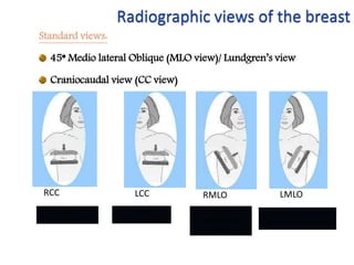 Breast mammography and tomosynthesis | PPTX