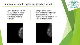 Mammografia 3d con tomosintesi - Associati Fisiomed | PPTX