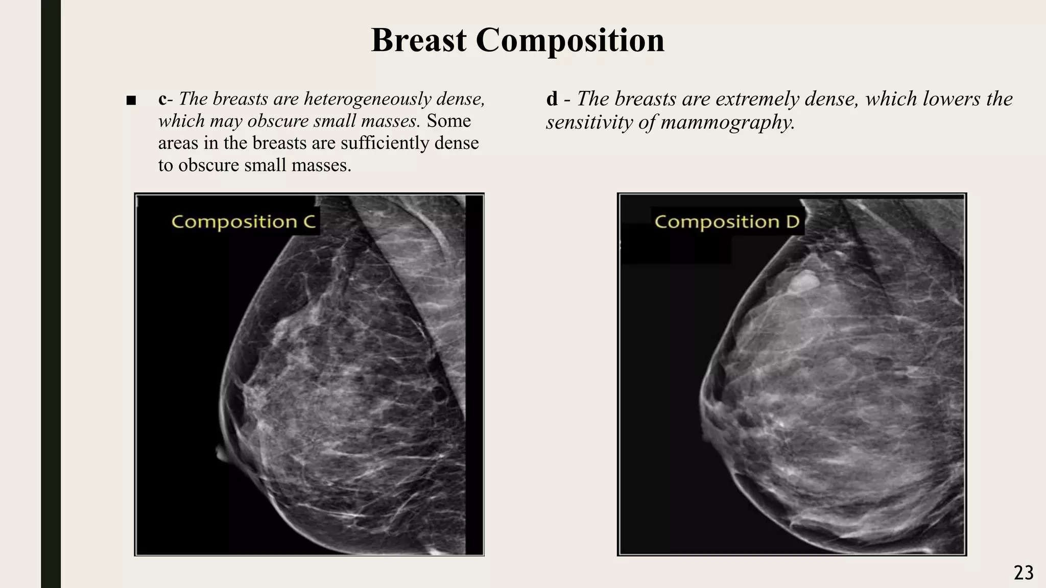 Mammogram and BI-RADS classification .pptx