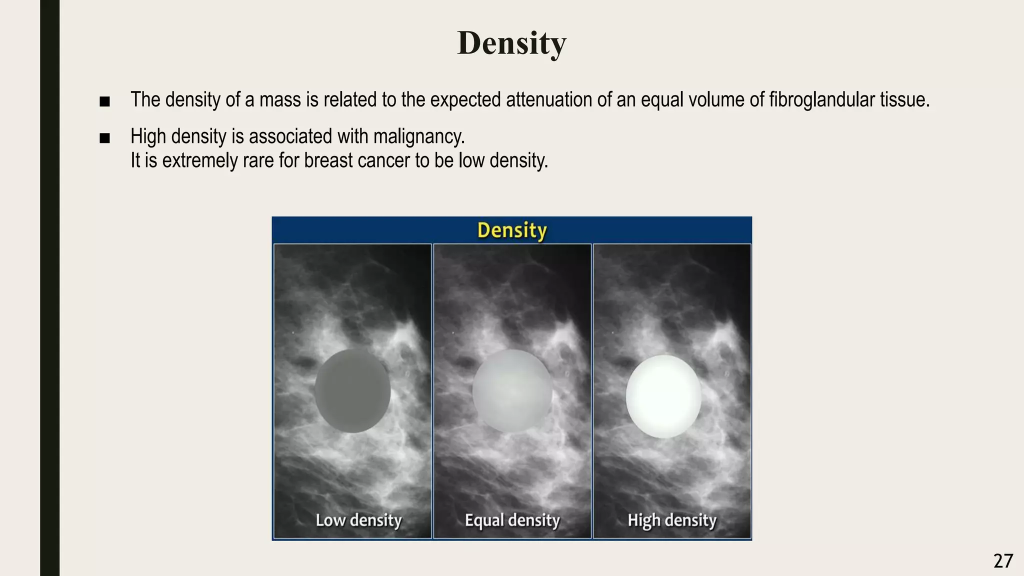 Mammogram and BI-RADS classification .pptx