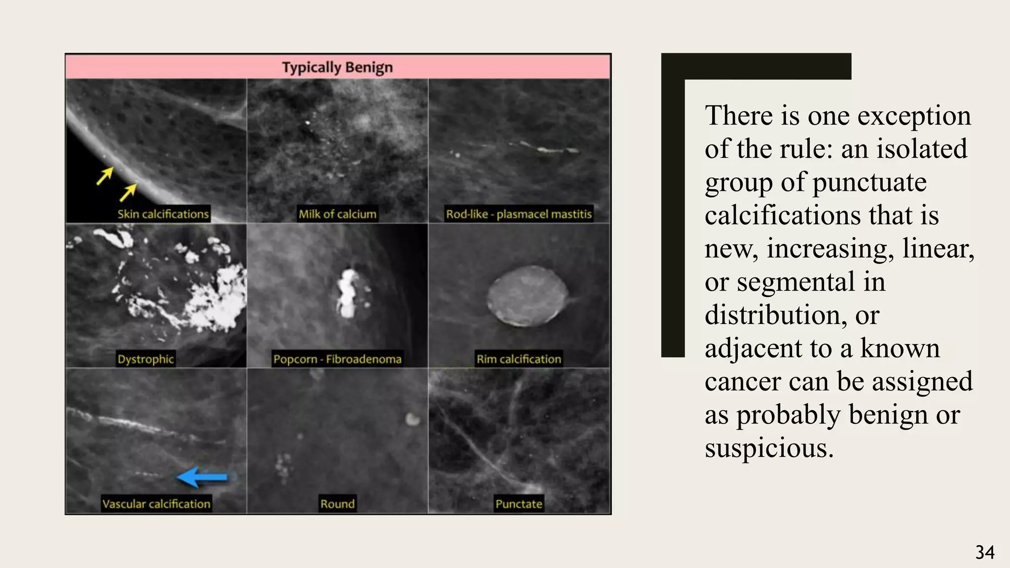 Mammogram and BI-RADS classification .pptx