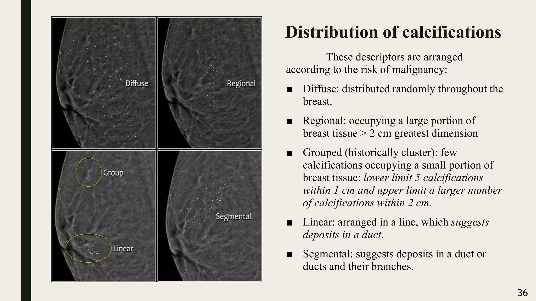 Mammogram and BI-RADS classification .pptx