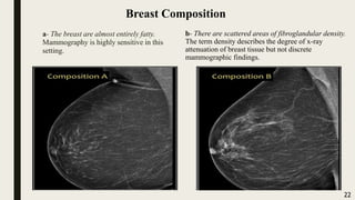 Mammogram and BI-RADS classification .pptx