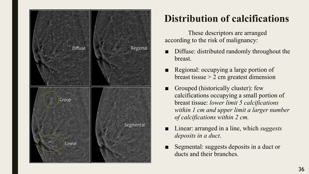 Mammogram and BI-RADS classification .pptx
