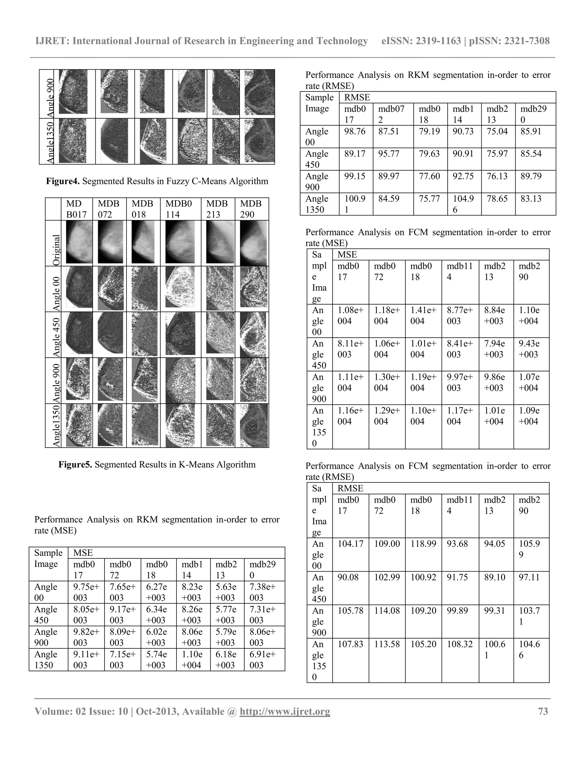 Mammogram Image Segmentation Using Rough Clustering Pdf
