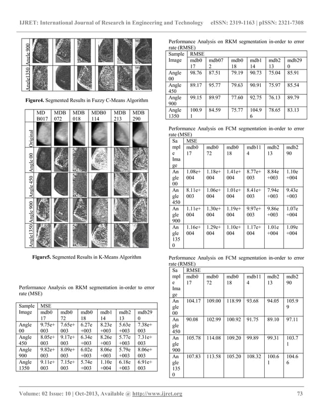Mammogram image segmentation using rough clustering | PDF