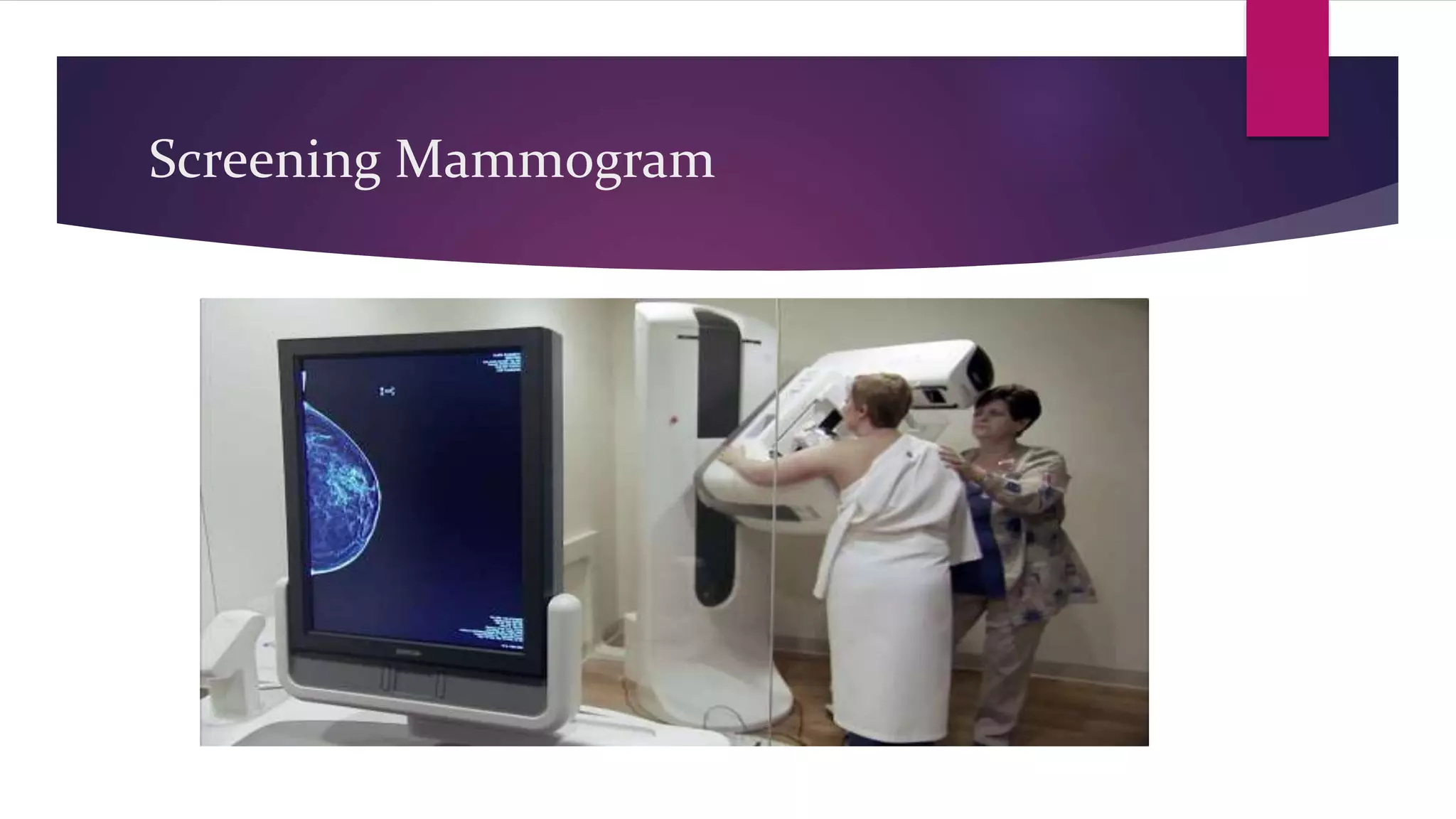 Mammogram screening | PPTX