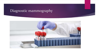 Mammogram screening | PPTX