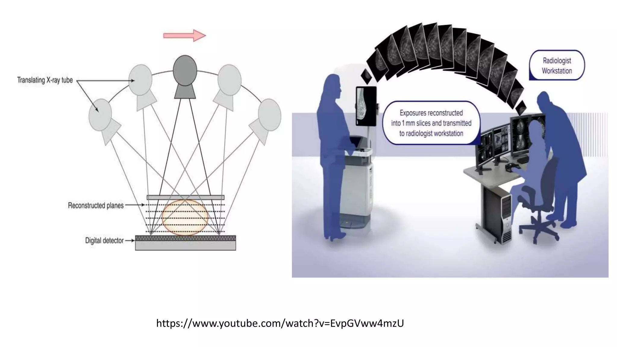 Mammographic equipment and its advancement | PPTX