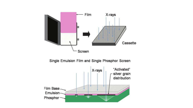 Mammographic equipment and its advancement | PPTX | Photography | Arts ...