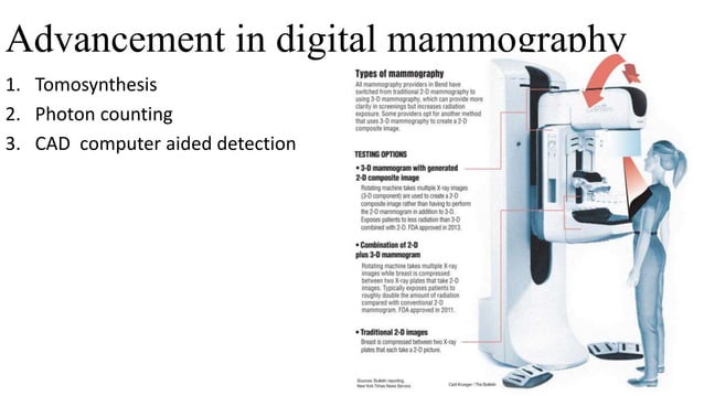 Mammographic equipment and its advancement | PPTX | Photography | Arts ...