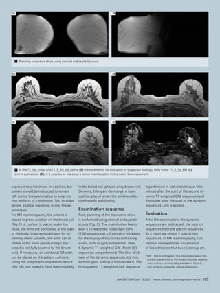 Mammography Protocol - SIEMENS | PDF | Medical Tests | Medical Health
