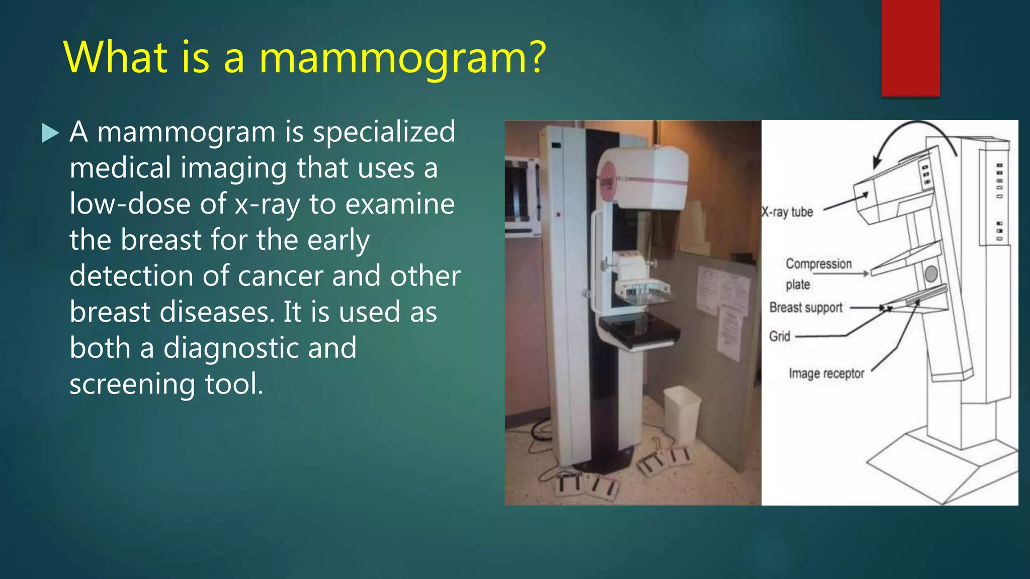 Mammography | PPTX
