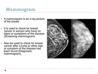 A Brief Overview of Mammography | PPTX