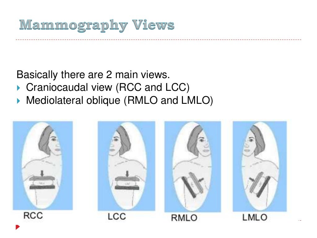 A Brief Overview of Mammography