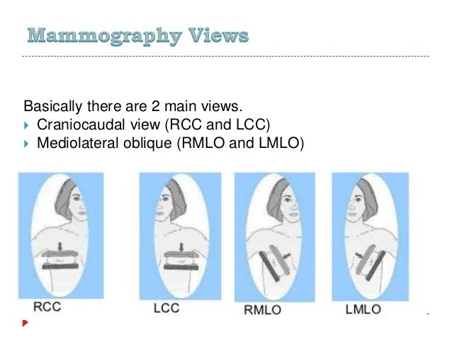 A Brief Overview of Mammography