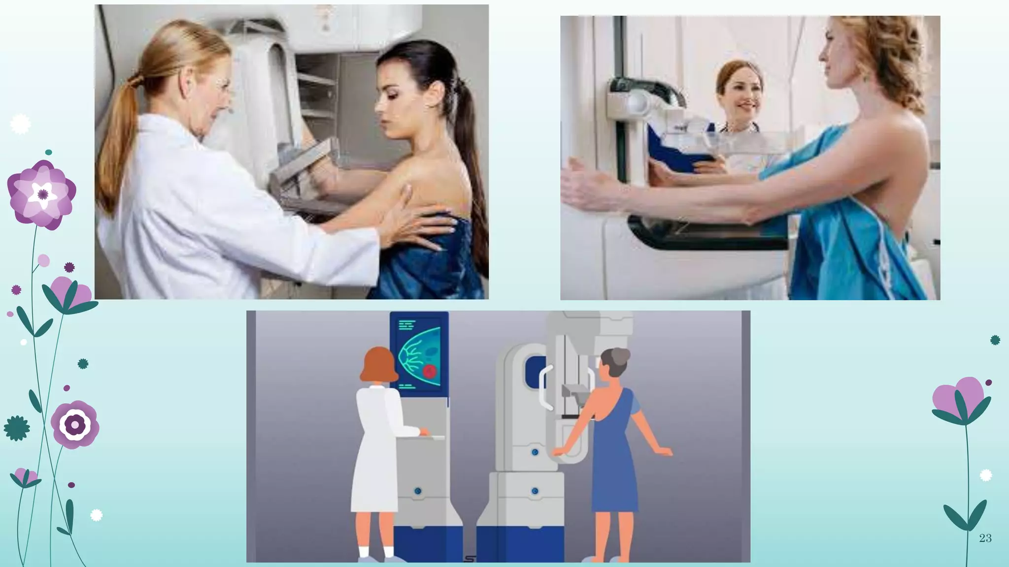 Mammography | PPTX