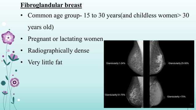 Mammography | PPTX