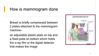 Mammography | PPTX