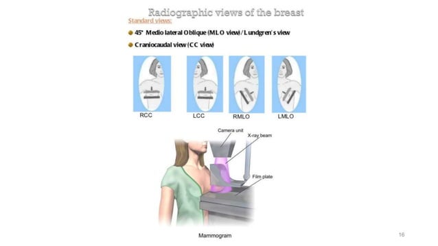 Mammography | PPTX