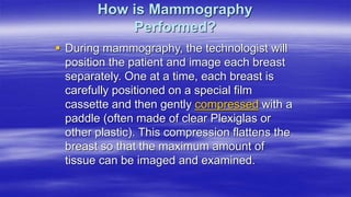 mammography.pptx