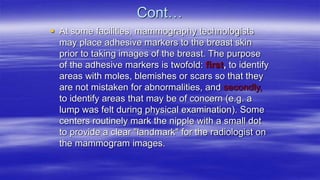 mammography.pptx