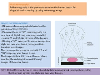 Mammography.pptx