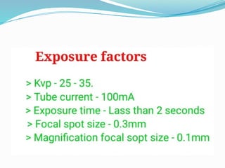 Mammography: X-Ray Tube Design, Image Acquisition Techniques, and ...