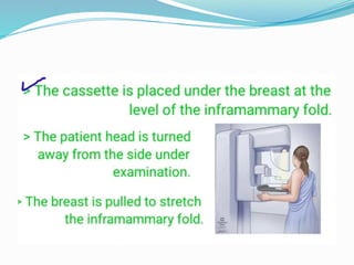 Mammography: X-Ray Tube Design, Image Acquisition Techniques, and ...