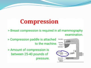 Mammography: X-Ray Tube Design, Image Acquisition Techniques, and ...