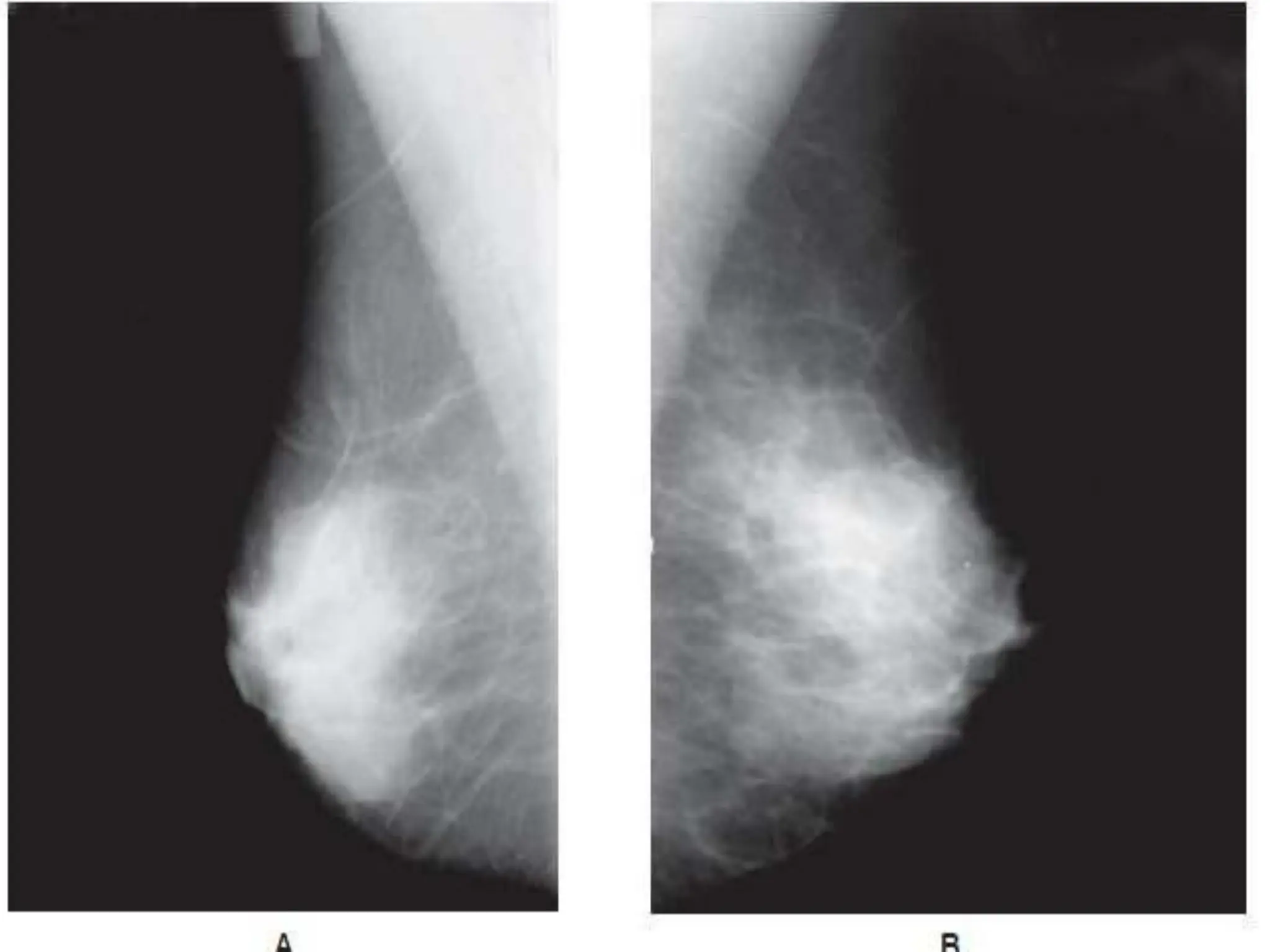 Mammography-Physics-and-Technique-PDF.pdf