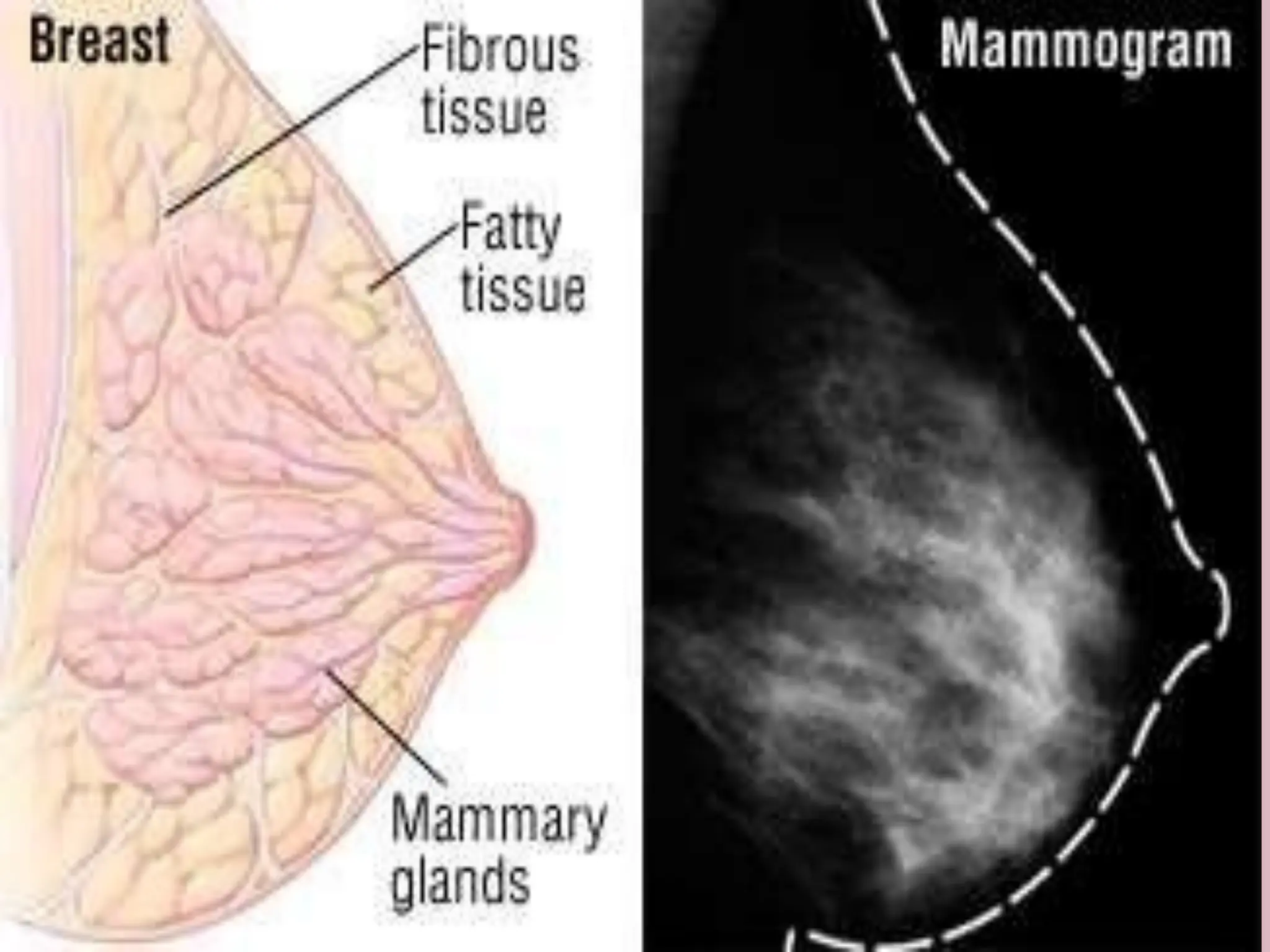 Mammography-Physics-and-Technique-PDF.pdf