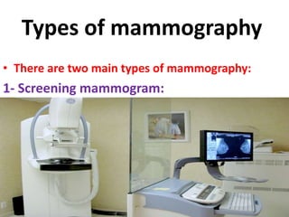 Mammography | PPTX