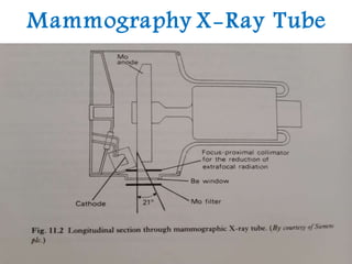 Mammography | PPT