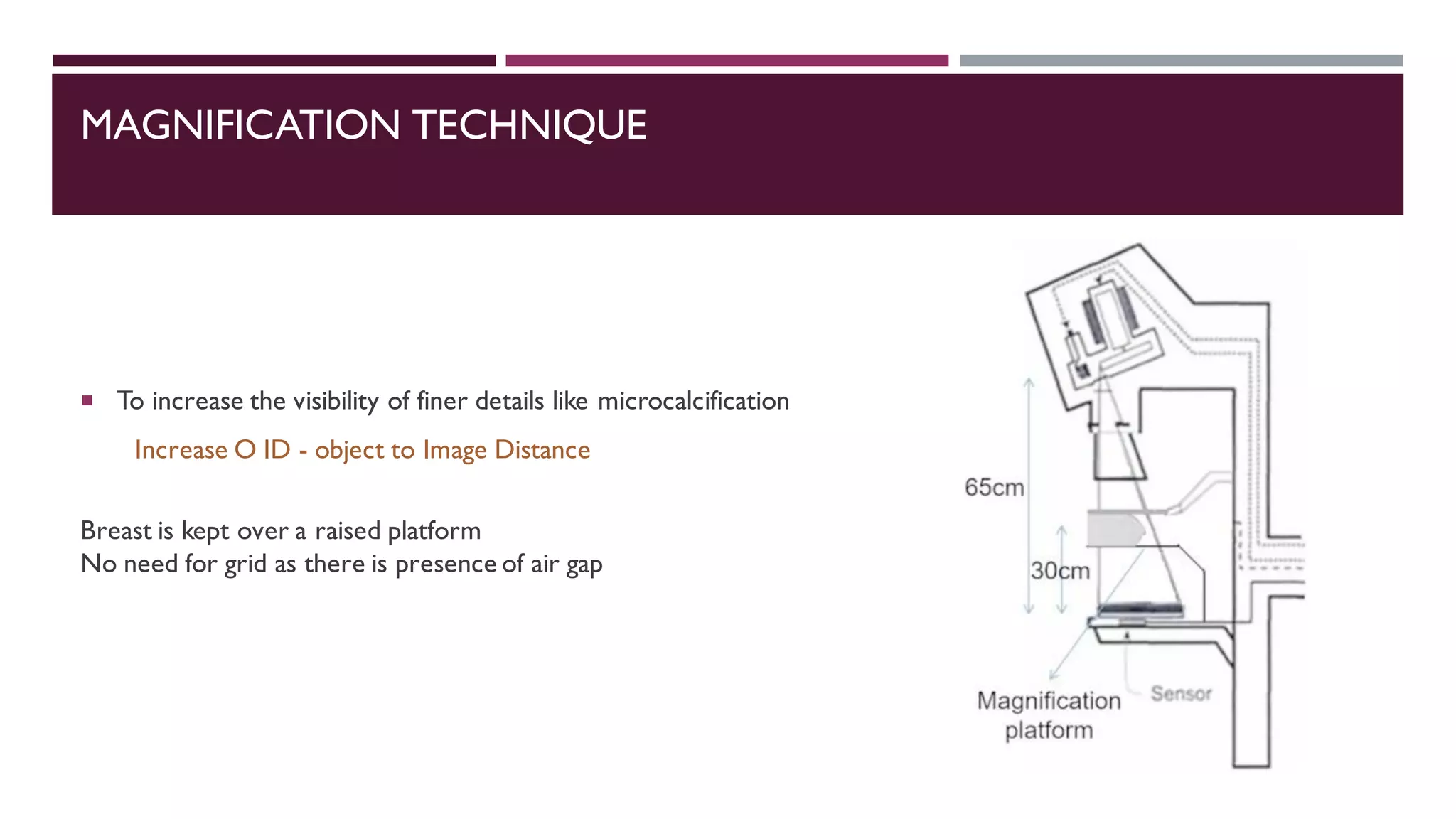 Mammography | PDF