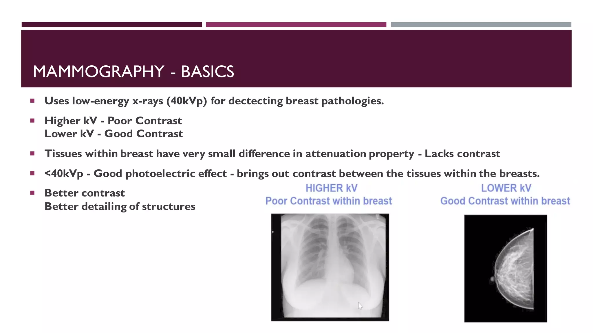 Mammography | PDF