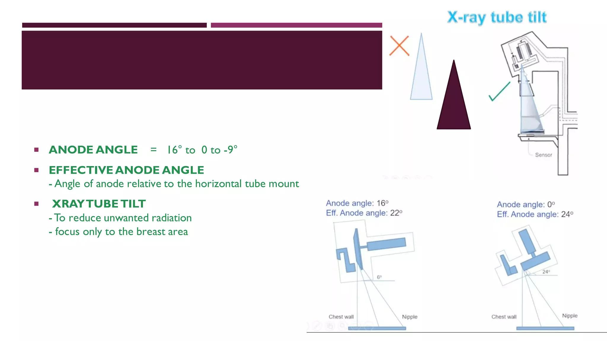 Mammography | PDF