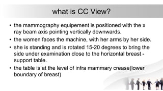 mammography | PPTX
