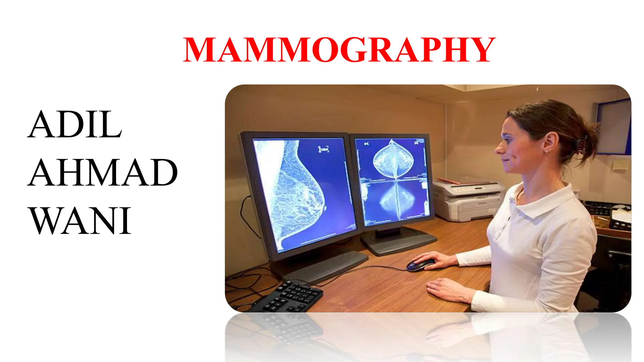 MAMMOGRAPHY VIEWS .ppt