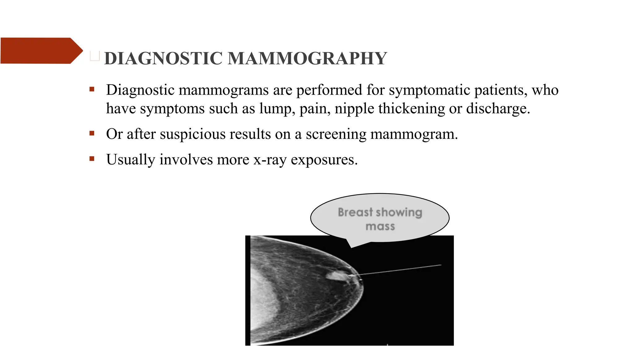 MAMMOGRAPHY VIEWS .ppt