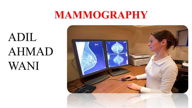 MAMMOGRAPHY VIEWS .ppt | Pregnancy | Reproductive Health