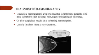 MAMMOGRAPHY VIEWS .ppt