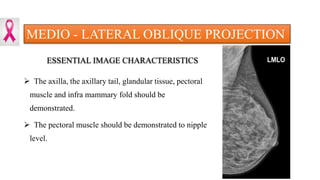 MAMMOGRAPHY VIEWS .ppt