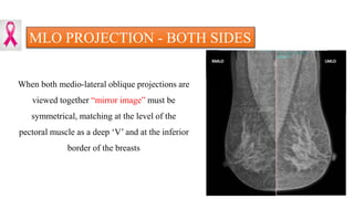 MAMMOGRAPHY VIEWS .ppt