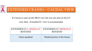MAMMOGRAPHY VIEWS .ppt