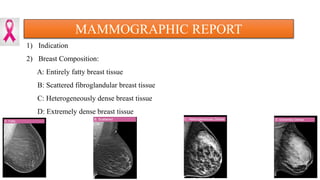 MAMMOGRAPHY VIEWS .ppt