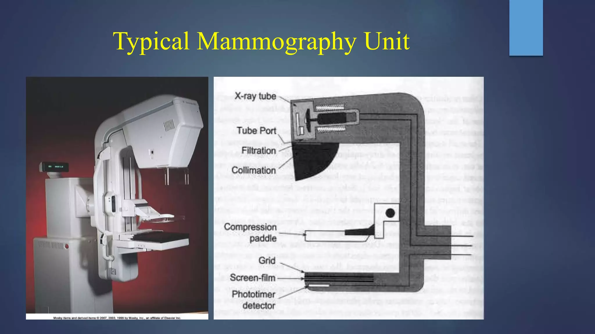 Mammography | PPTX